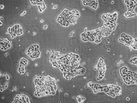 Calu-3 Human Lung Adenocarcinoma Cell Line | SCC438